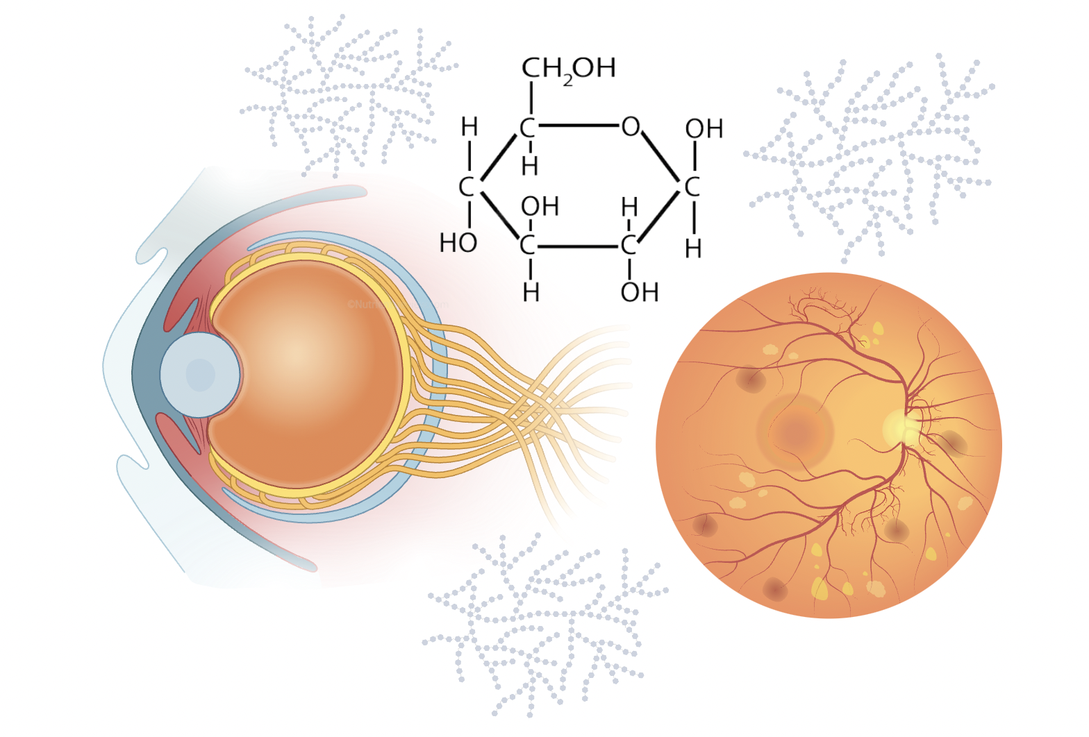 Effect of Glucose Intolerance on Refractive Error - Jass Stem Association